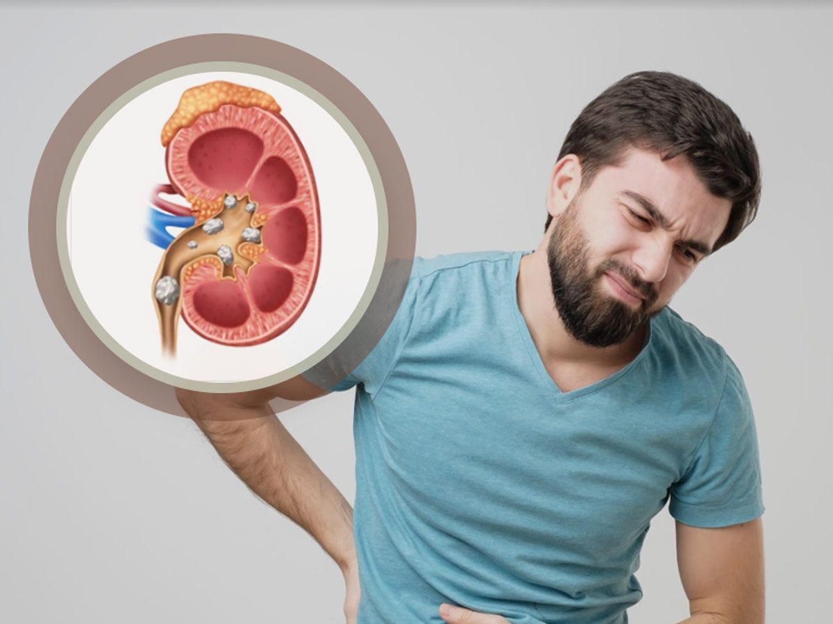 Laser Stone Hospital For All Urological Problems